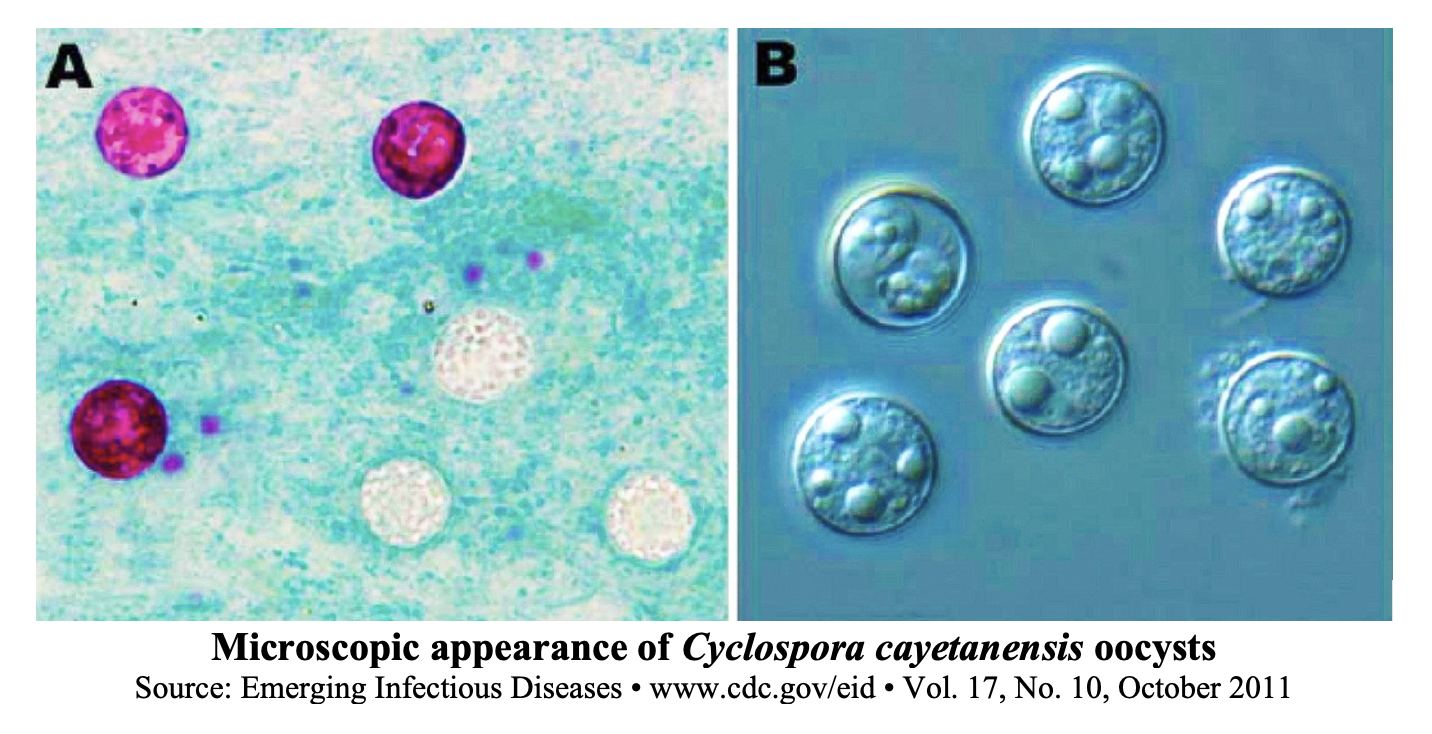 What is Cyclospora cayetanensis? | Cyclospora Blog